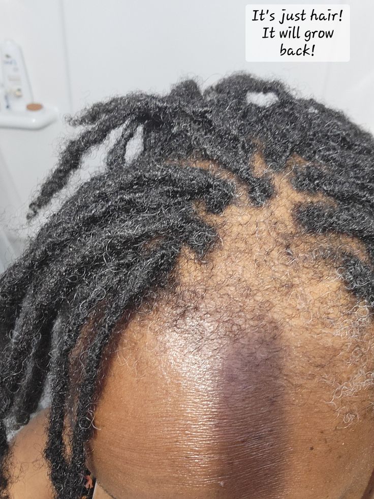 How to Strengthen Weak Locs